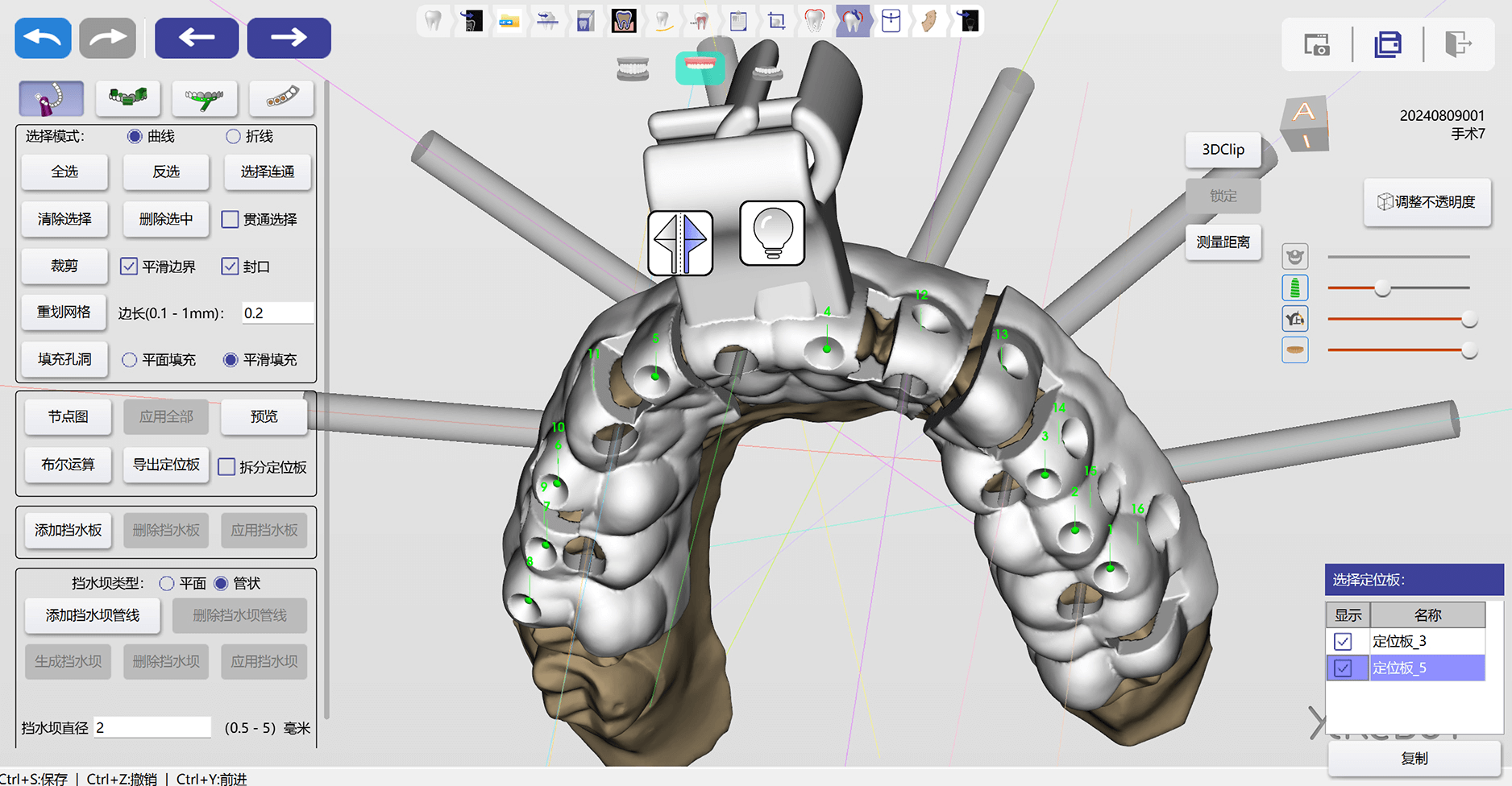 雅客智慧口腔种植系统，安全、精准、高效、微创的数字化口腔医疗机器人！
