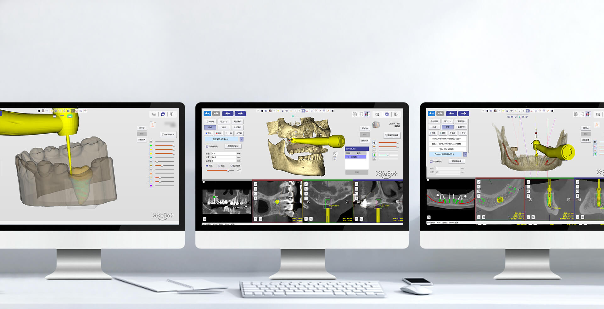 雅客智慧口腔种植系统，安全、精准、高效、微创的数字化口腔医疗机器人！