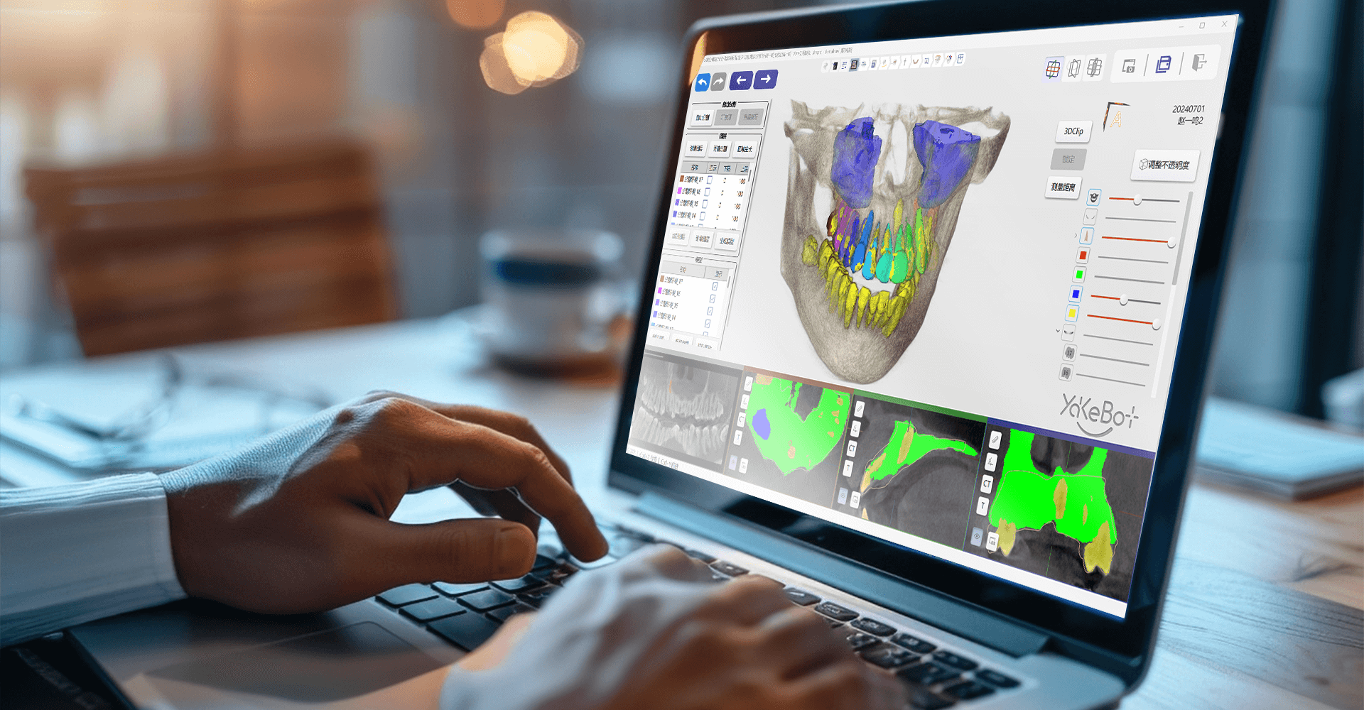 雅客智慧口腔种植系统，安全、精准、高效、微创的数字化口腔医疗机器人！